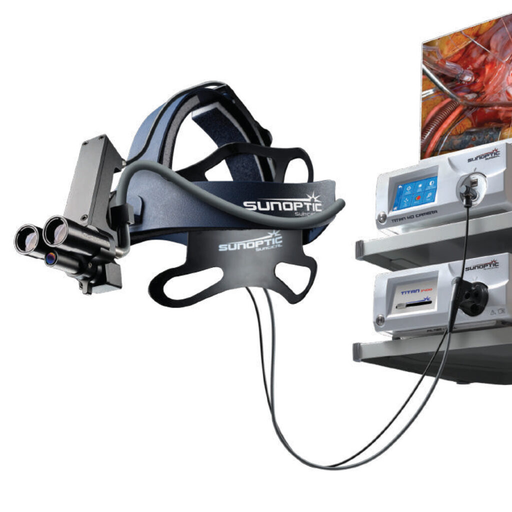 HDC300 Surgical Headlight Camera System - Uniplex (UK) Ltd